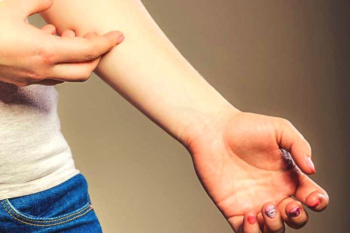 Nickel Allergy: What To Eat And What To Avoid