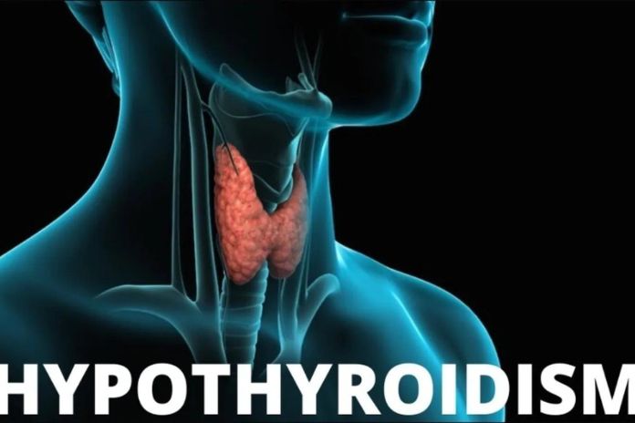 Hypothyroidism Diet: What To Eat And Foods To Avoid